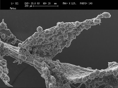 Botany Without Borders: Questions about lichens: Form? Function? Biology?