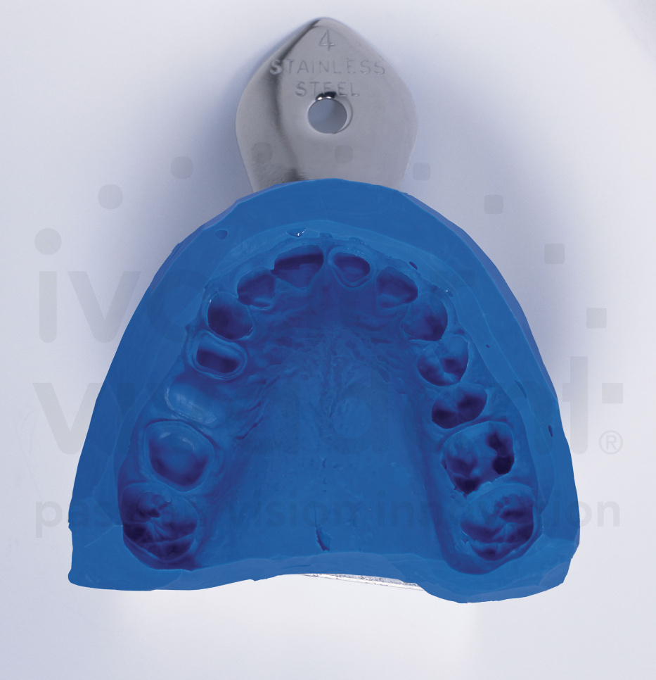 Materiales Dentales : Materiales para la toma de impresiones