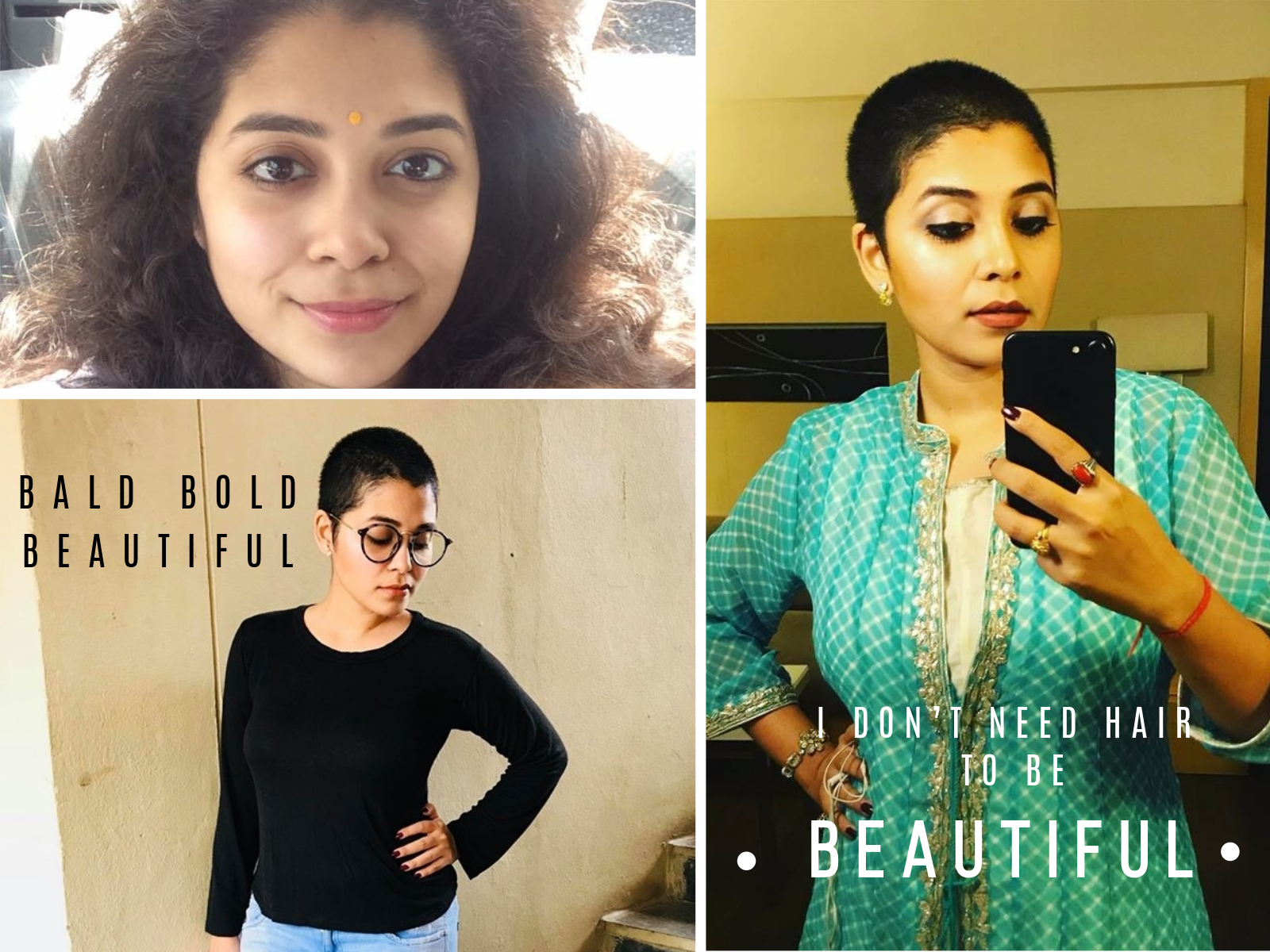 Damini Bhatla - Bald Bold and Beautiful - All About Hair