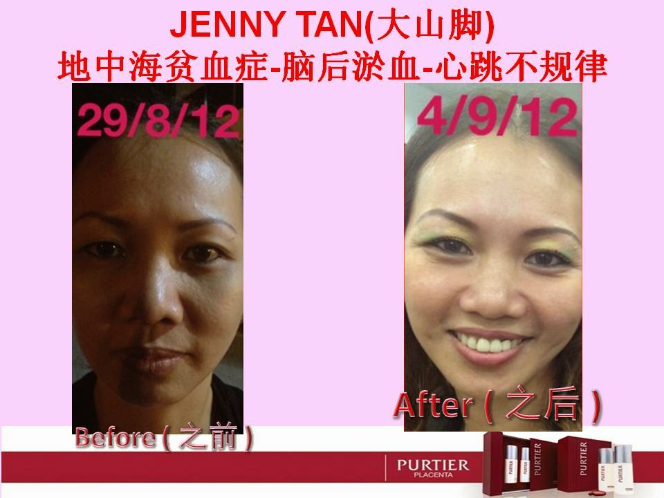 purtier placenta live stem cell