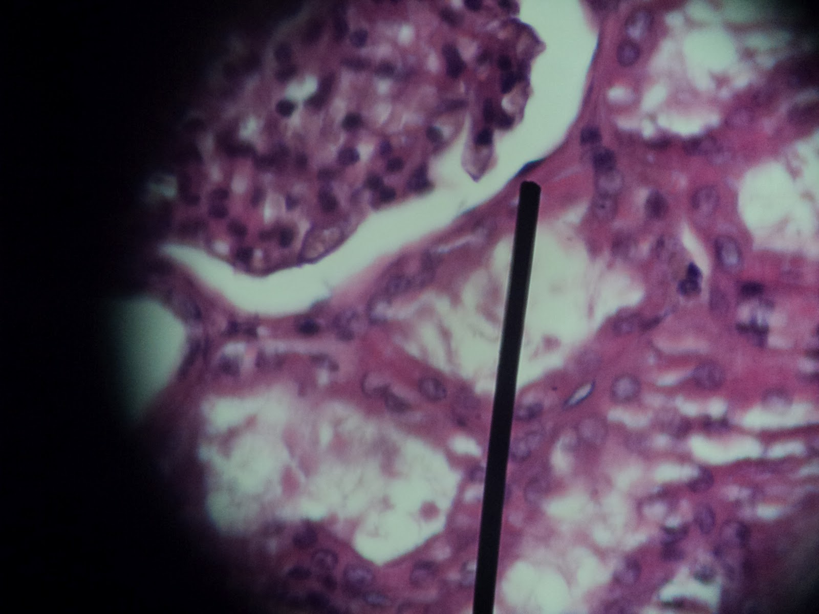 MEDICINA USMP: FOTOS DE HISTOLOGIA II - CÁPSULA DE BOWMAN