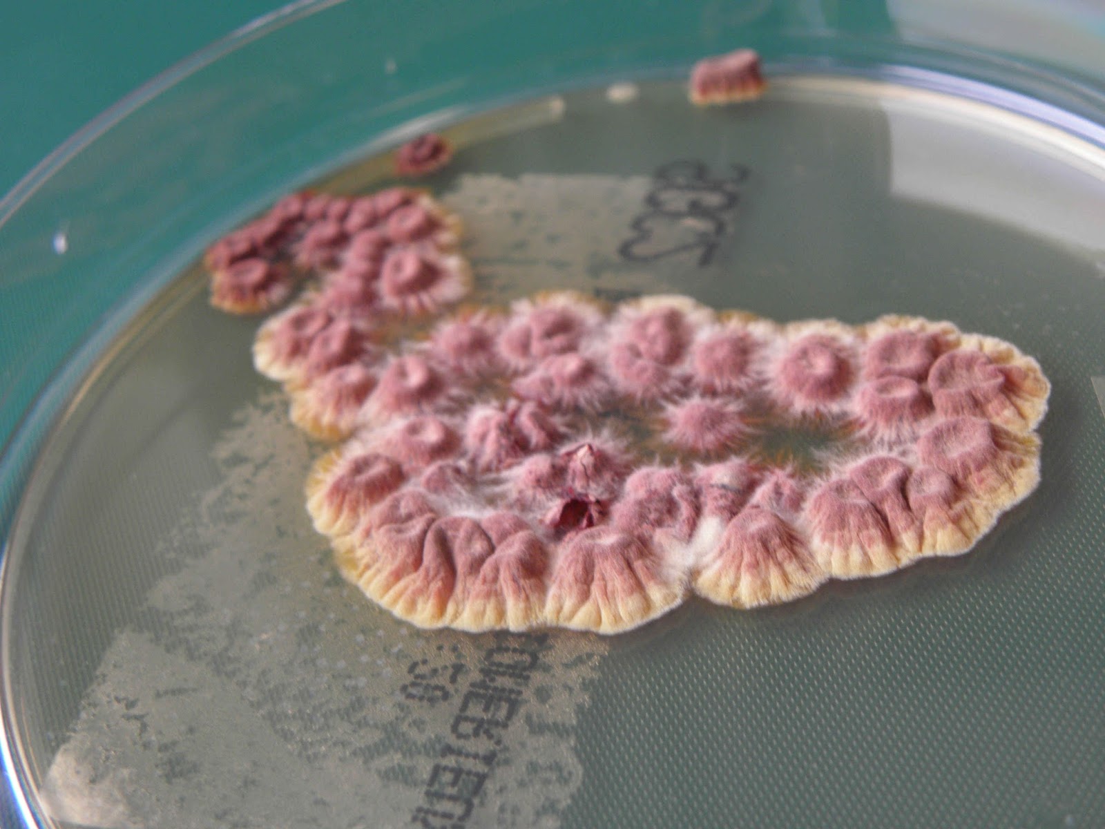 ATLAS MICOLOGIA: TRICHOPHYTON SOUDANENSE (II)