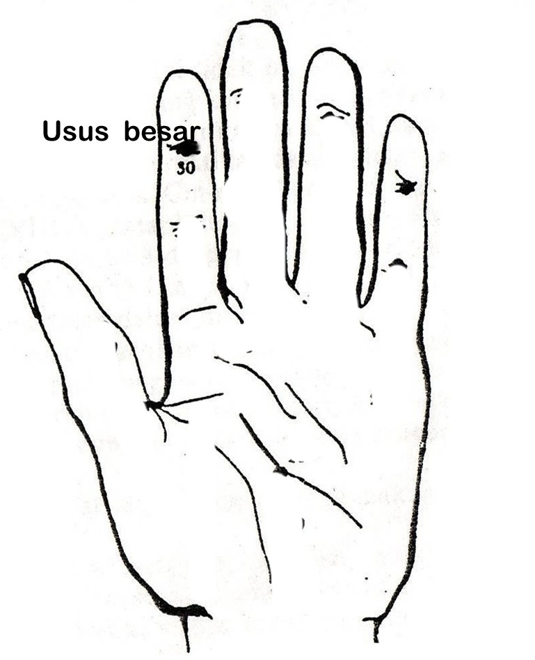 Gejala Dan Pengobatan FOMITUS ( MUNTA MUNTA ) - PENYUMBATAN