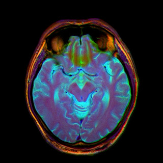 Nevit's blog: Color MRI of the Brain
