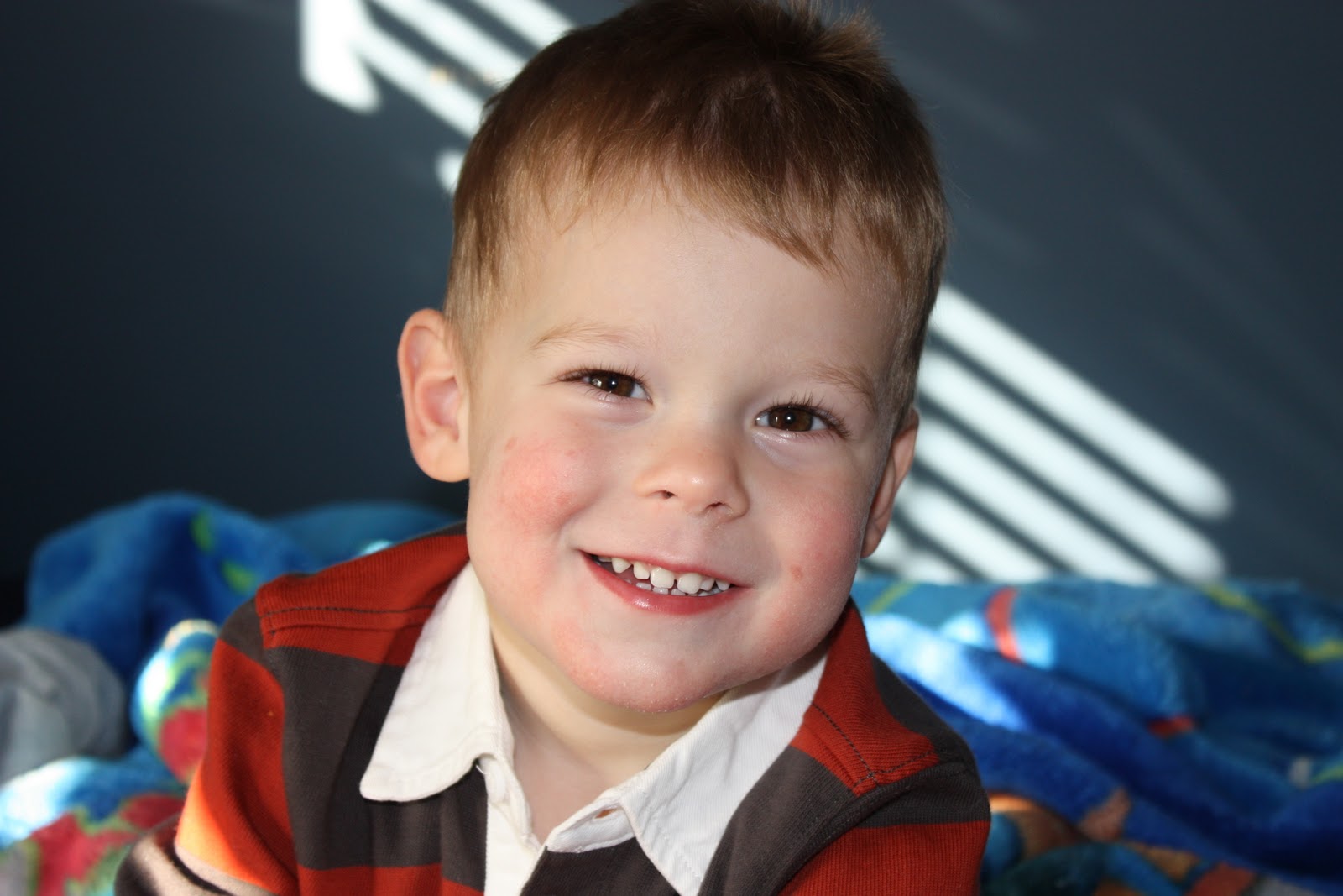 Juvenile Xanthogranuloma Online Support: JXG Champs