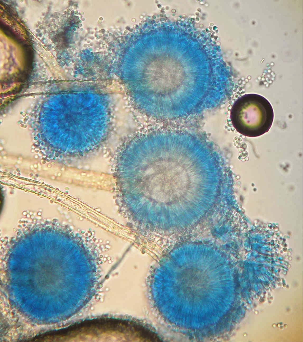 ATLAS MICOLOGIA: ASPERGILLUS OCHRACEUS