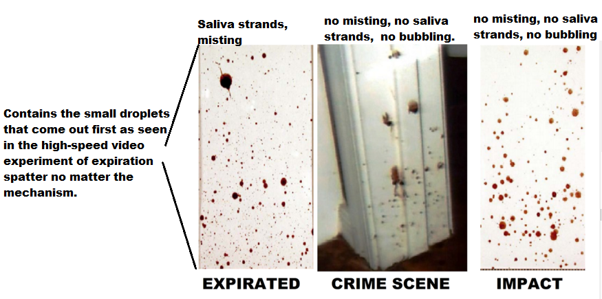 Expirated Blood Pattern