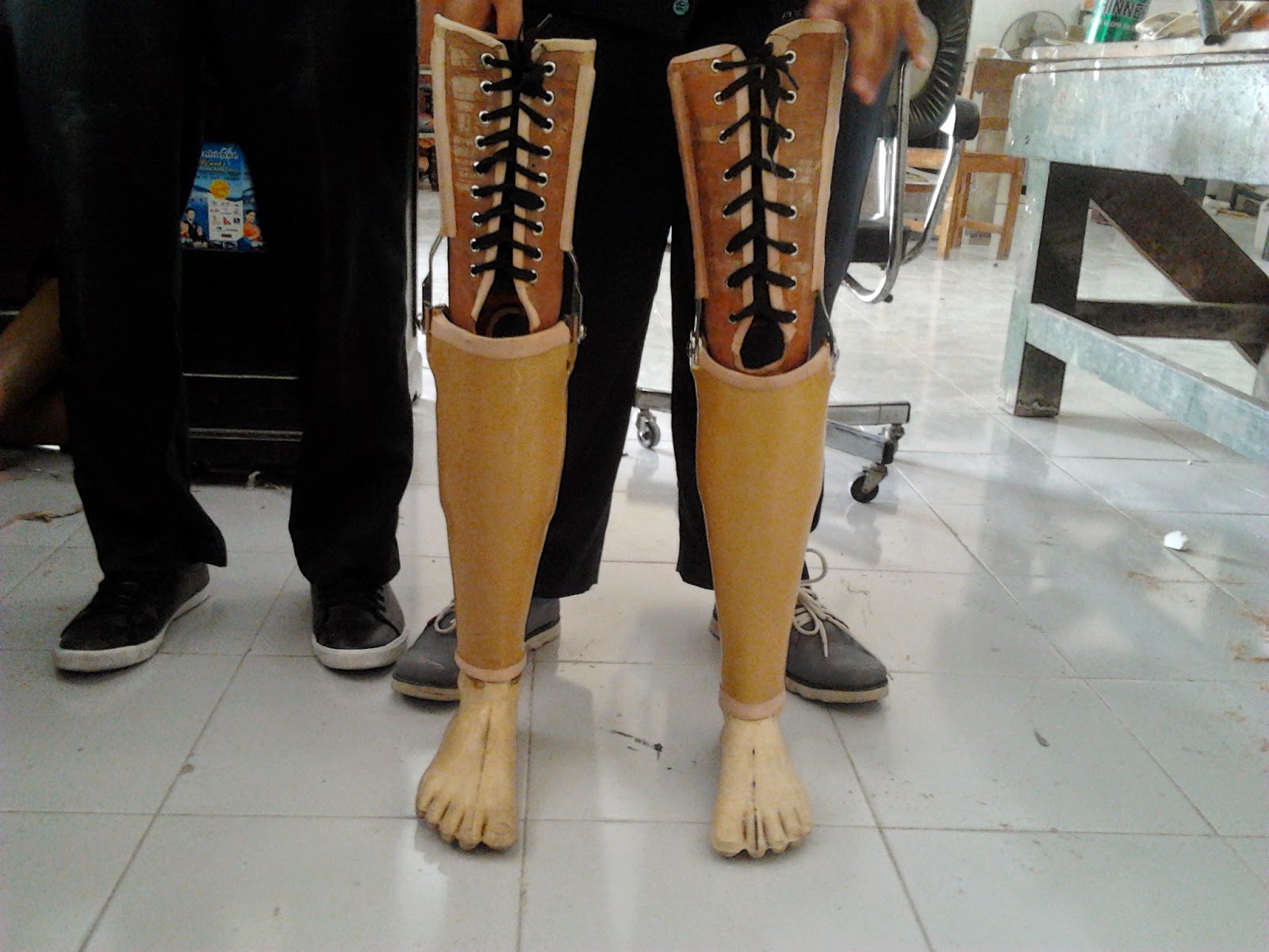 Prostheses Kaki | Ataka Medical Center