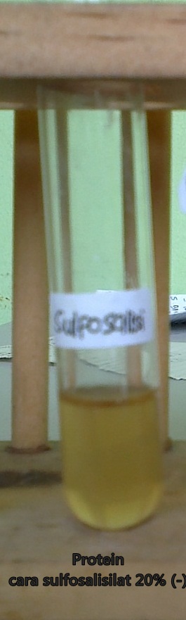 Pemeriksaan Urinalisis Lengkap | Analis Kesehatan