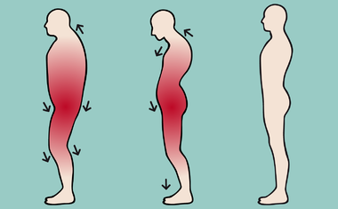 Štěpán Pospíšil - kondiční trenér: Svalové dysbalance – jak to vypadá?