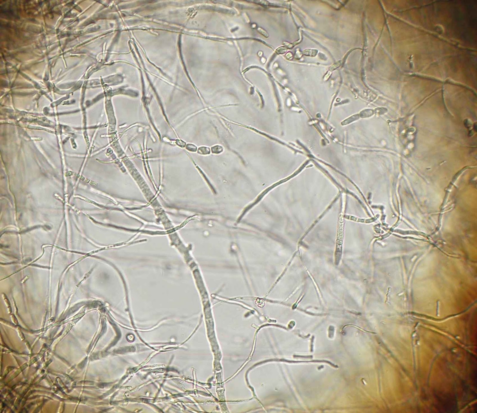 ATLAS MICOLOGIA: SCYTALIDIUM DIMIDIATUM (Neoscytalidium dimidiatum)