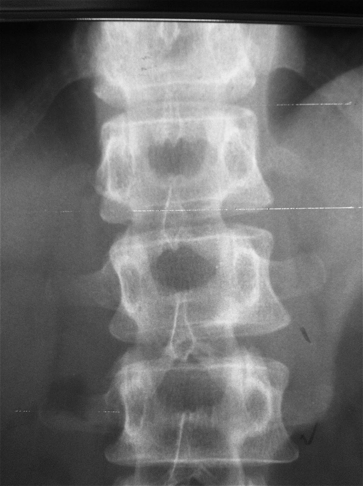 MedView Medical Imaging Consultancy Info Page: Dealing with normal ...