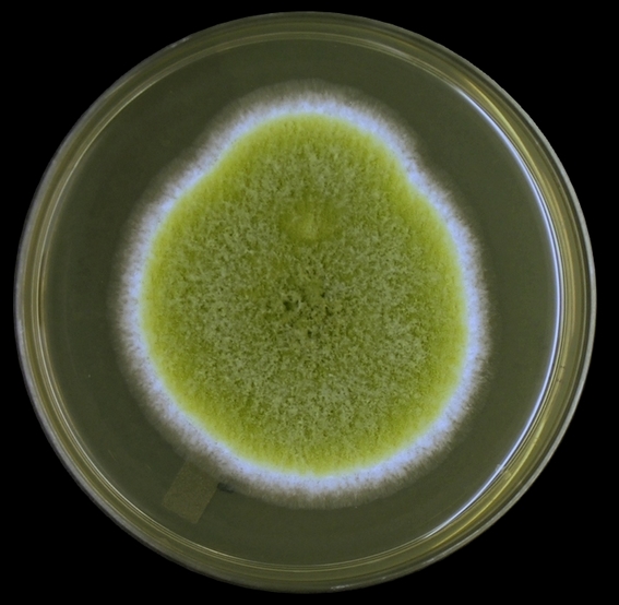 Fun With Microbiology (What's Buggin' You?): Aspergillus flavus