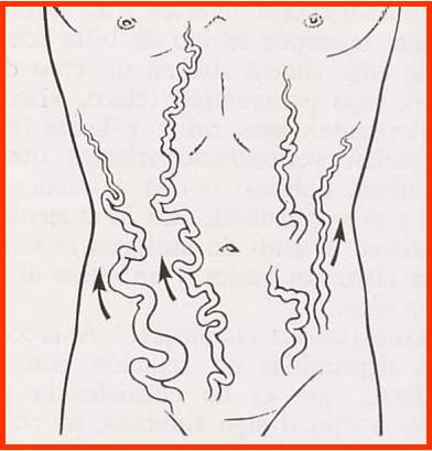 Apuntes De Semiología Quirúrgica: EXAMEN DE ABDOMEN