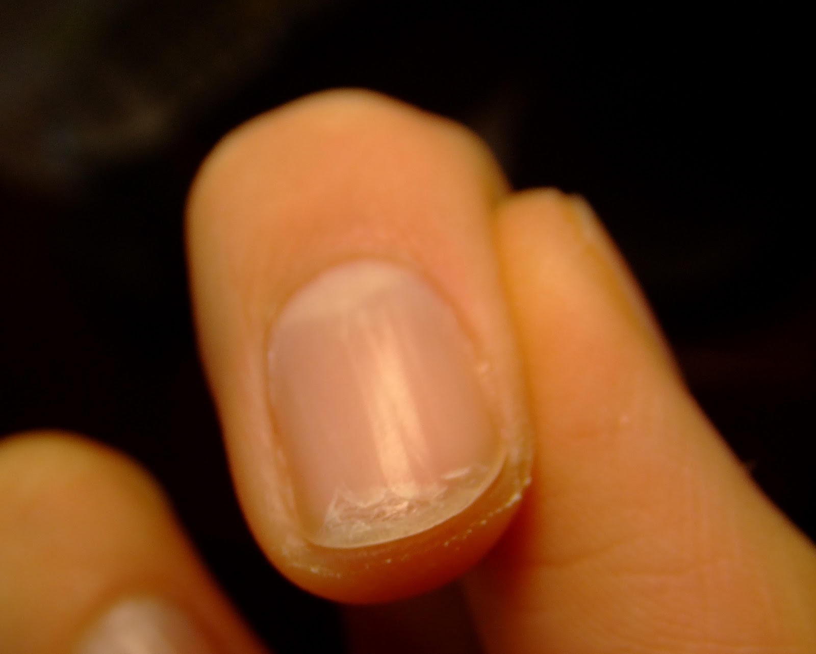 Distração na mão: Unhas fracas e quebradiças? Saiba o que fazer!