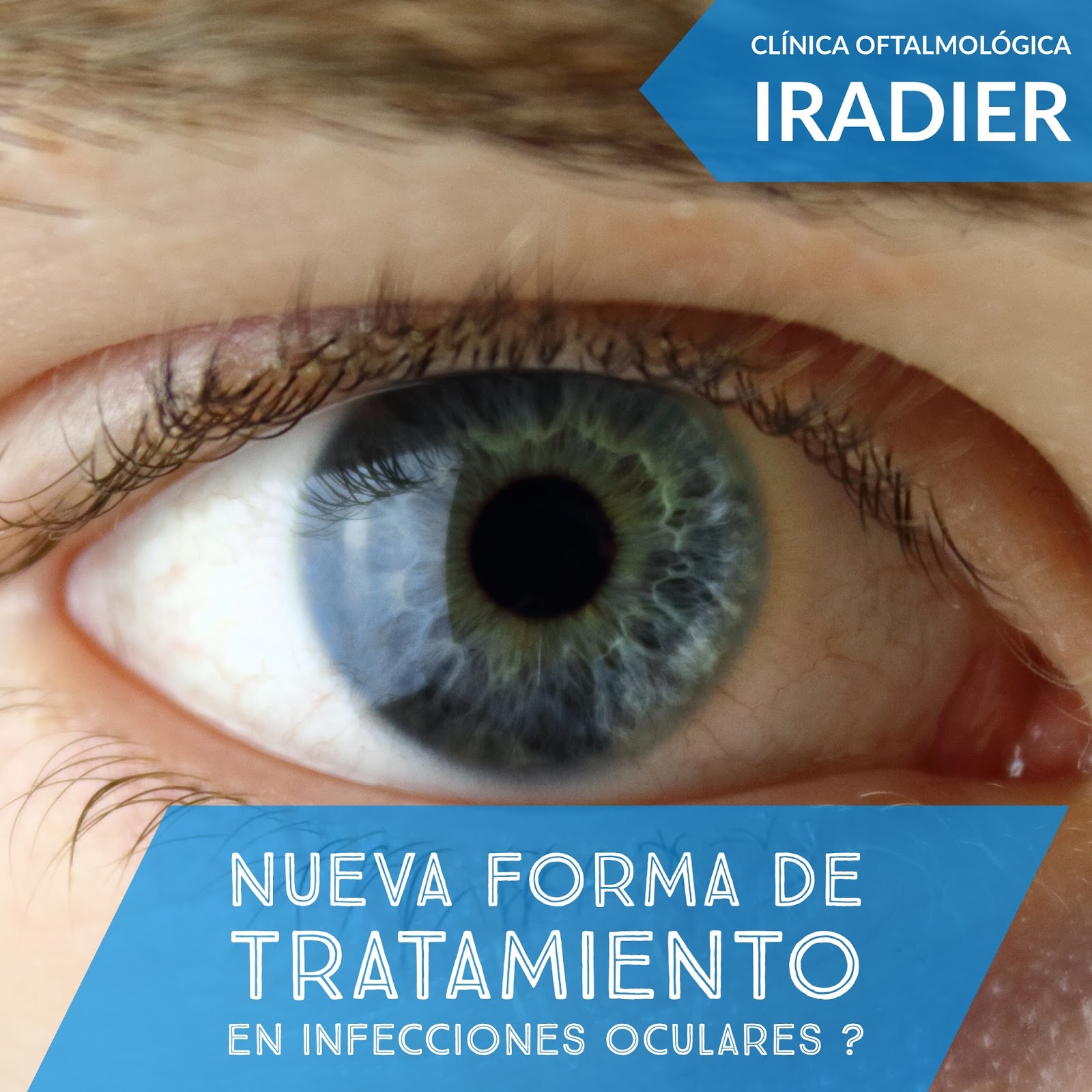 - Dra Maria Teresa Iradier Oftalmologo