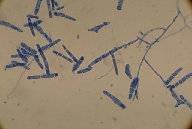 Microbiología y Epidemiología: Epidermophyton floccosum