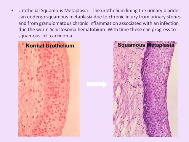 EXAMS AND ME : Metaplasia