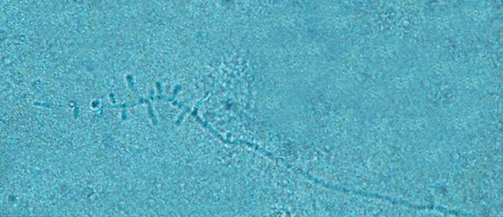 ATLAS MICOLOGIA: TRICHOPHYTON TONSURANS (2)