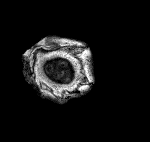 Anthony Luke's not-just-another-photoblog Blog: Amazing MRI Images of ...