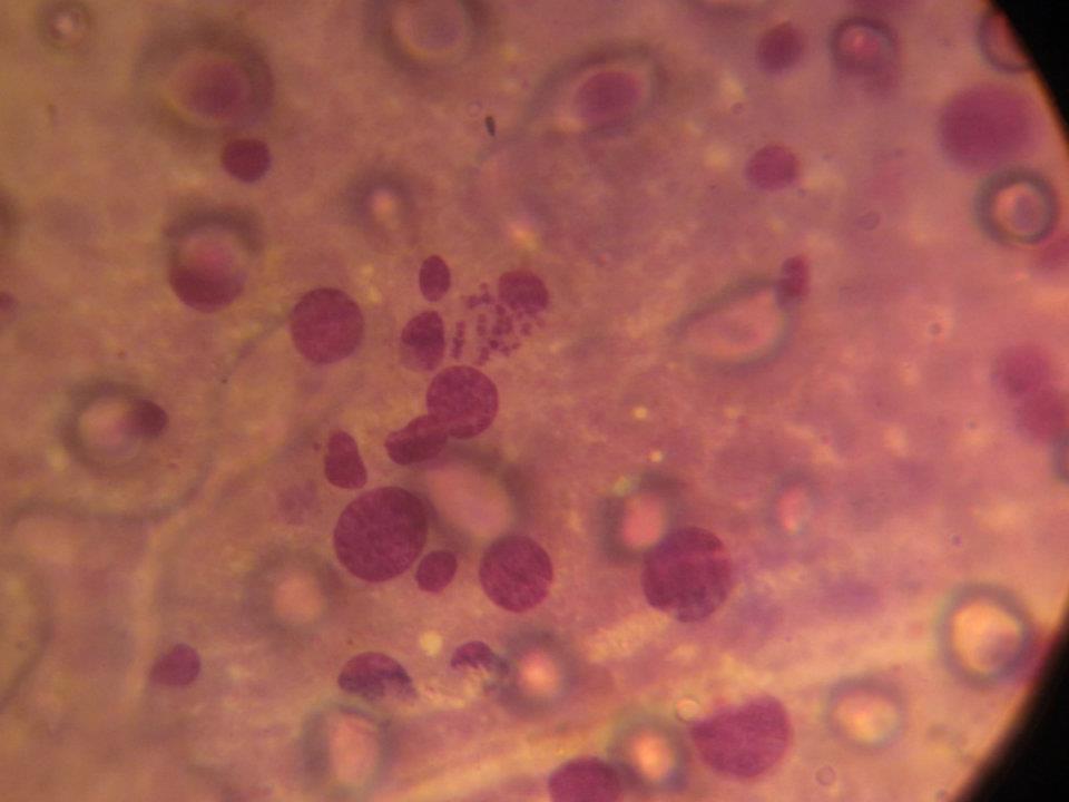 Izyan Hamizi: Protozoas Revision.