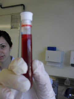 Citologia Clínica - 2011: LCR - Câmaras