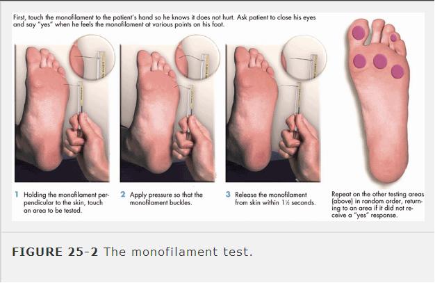 Diabetes Mellitus: Nursing Interventions