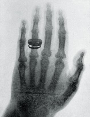 CIENCIA PARA NO CIENTIFICOS: La primera radiografía de la historia