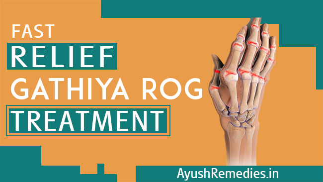 Best Ayurvedic Fast Relief Treatment for Gathiya Rog in India