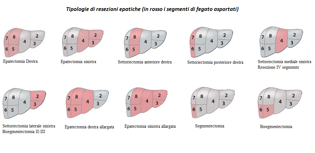 Manuali di Medicina Intensiva: Fegato in Medicina Intensiva (Capitolo 4 ...