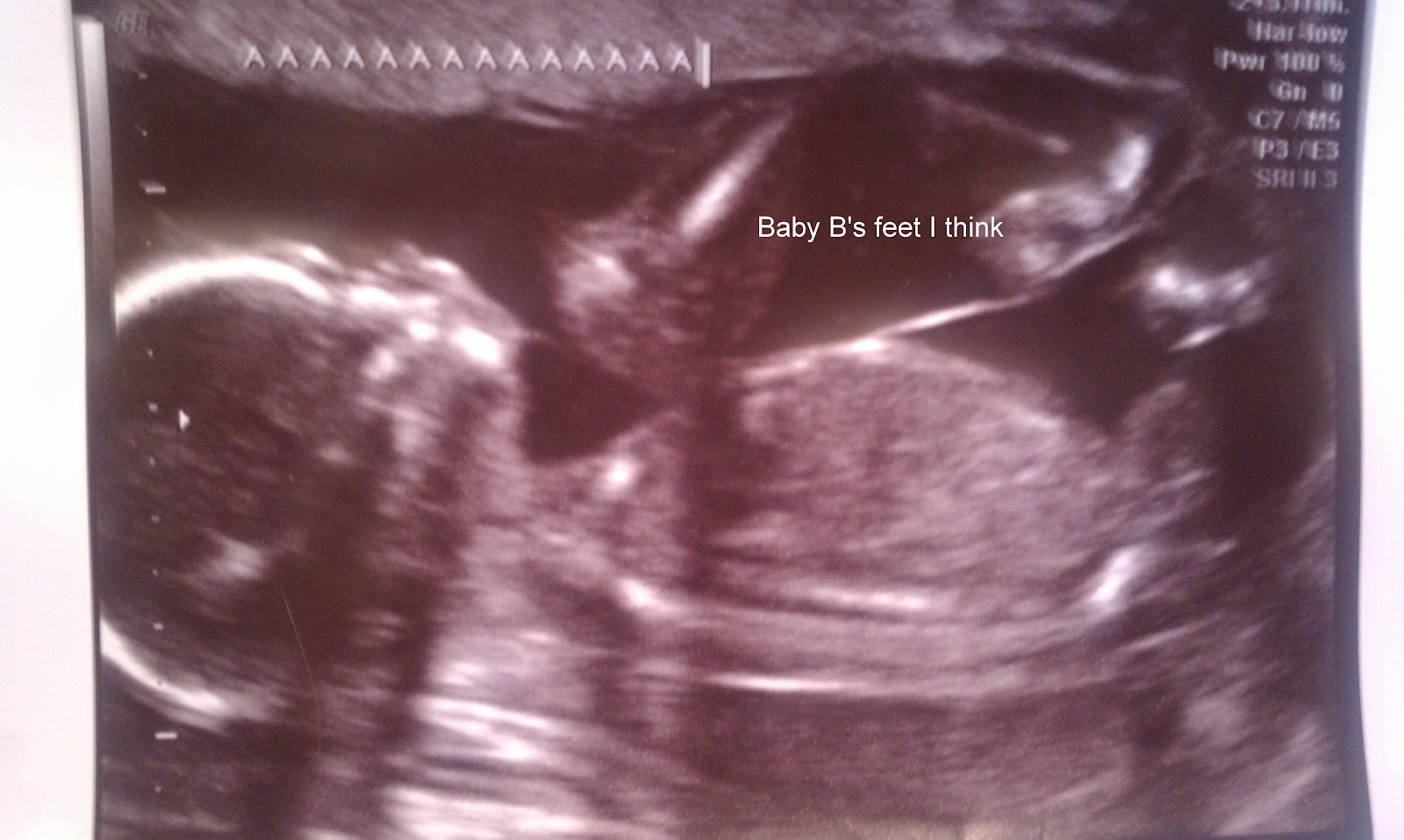 Red Fish, Blue Fish, We're Having a Third Fish!: 16 Week Ultrasound