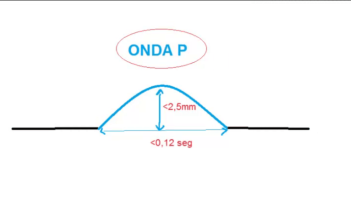 FUNDAMENTOS DE ELECTROCARDIOGRAFIA : ALTERACIONES DE LA ONDA P