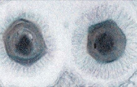 InfoCemen : Megavirus Chilensis, Virus Terbesar yang Pernah Ditemukan ...