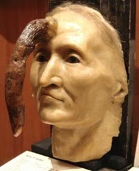 Woman With Horn - Human Horn