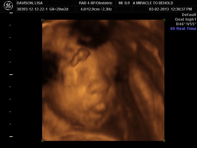 Pickles 'n Pink: 28 Weeks & 4D Ultrasound