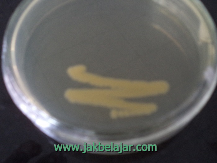 Mengenal Metode Streak Plate dalam Isolasi Bakteri - JakBelajar