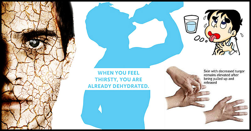 DEHYDRATION: The Signs and Complications | Dr Farrah MD