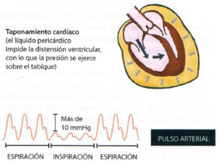 Detrás de la consulta: Semiología del Pulso Arterial.