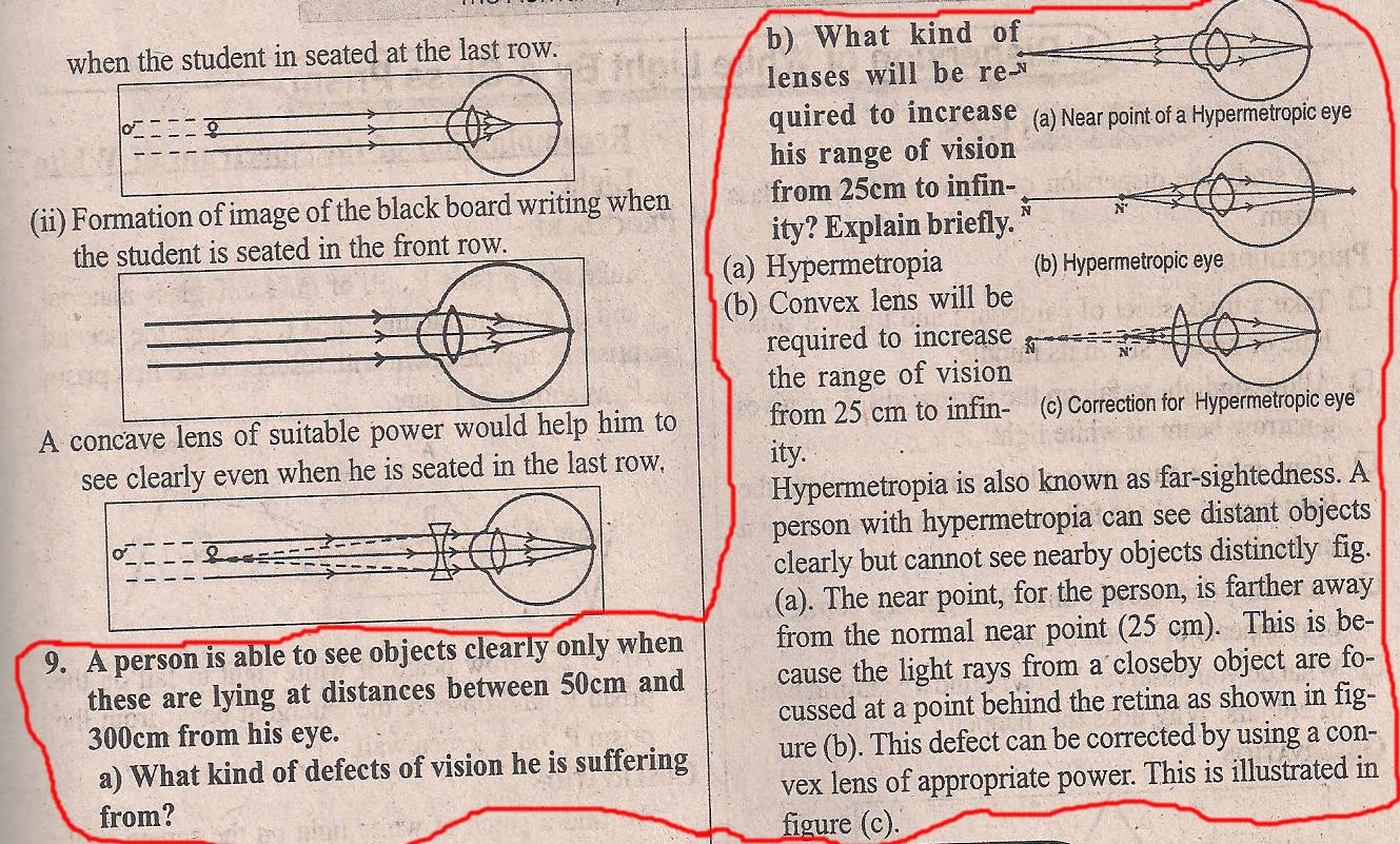 This World Is So Small Difference Between Hypermetropia And Presbyopia