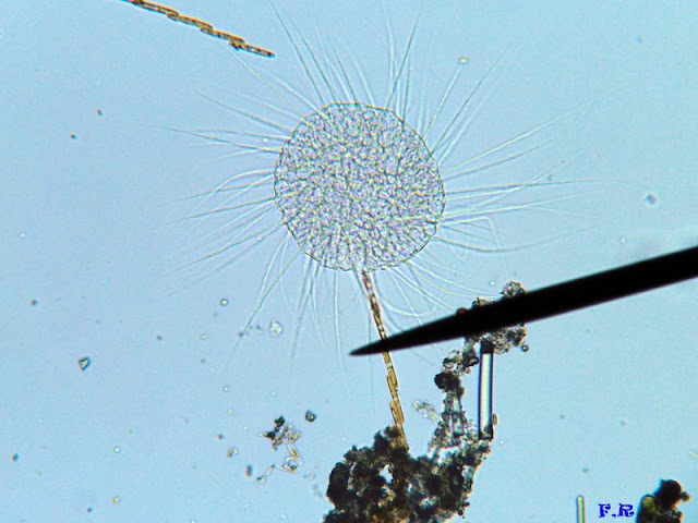 Microorganismo del agua.: HELIOZOO.