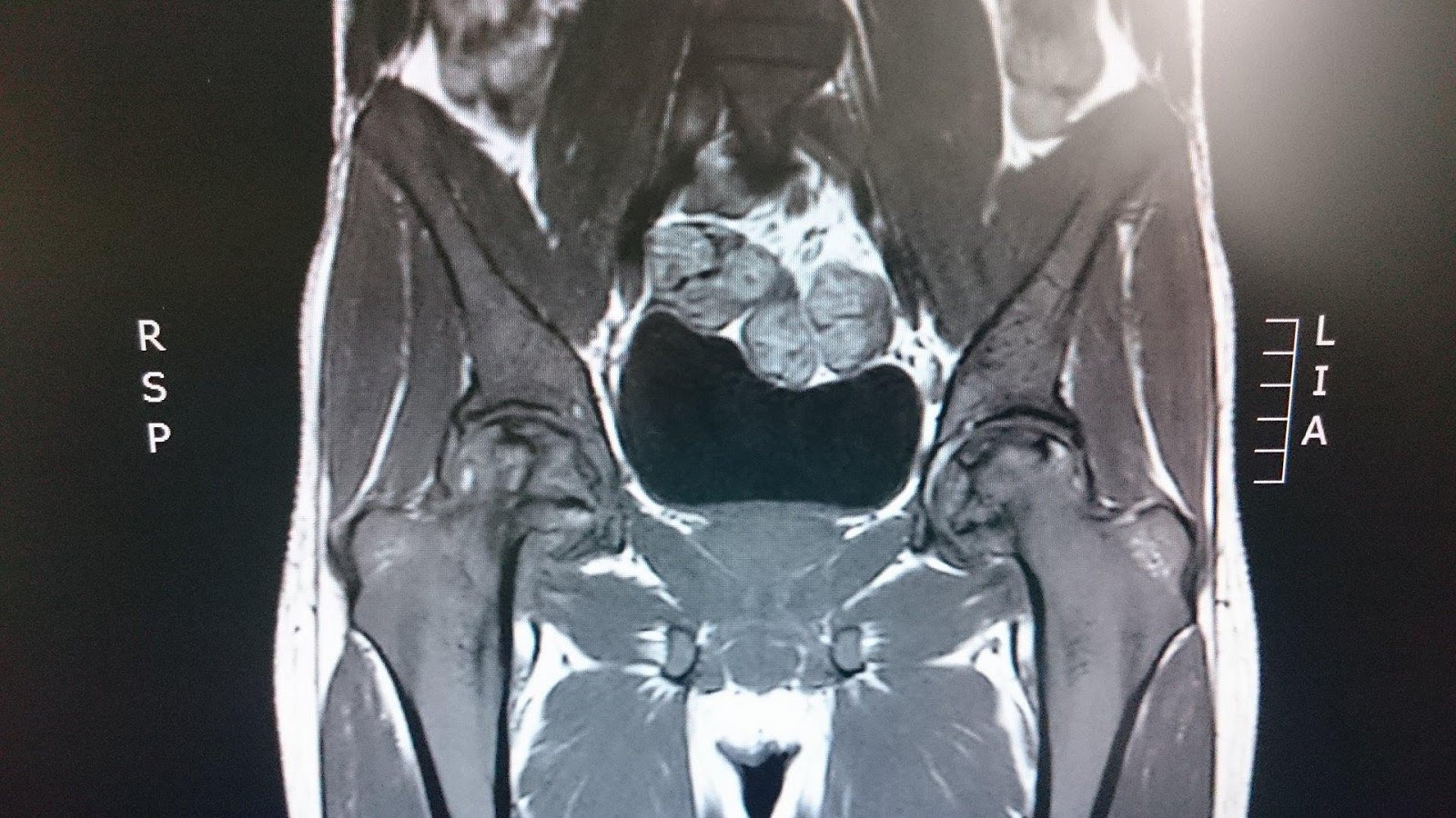 EL RINCÓN DE LA MEDICINA INTERNA. juanpedromacaluso@yahoo.com.ar: 8 mar ...