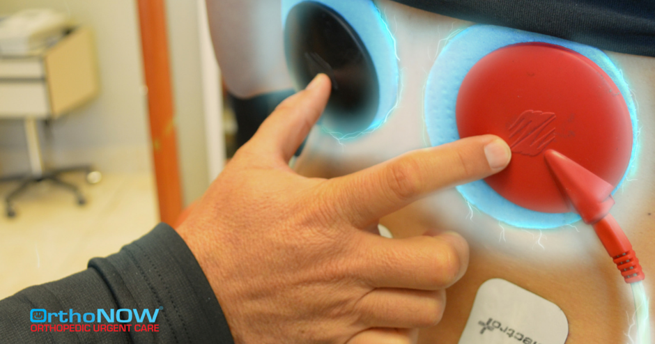 OrthoNOW® Aventura: WHAT IS ARP WAVE NEURO THERAPY?