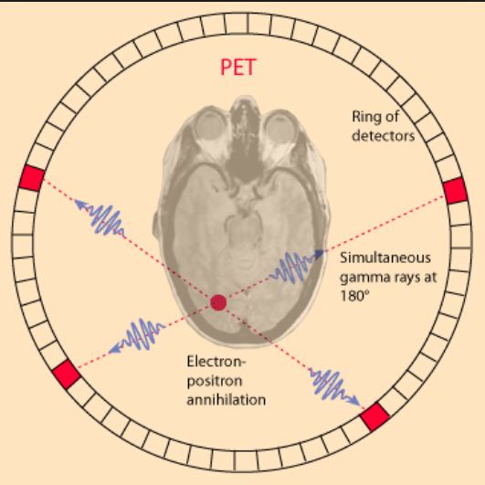 Pet Scanner Diagram