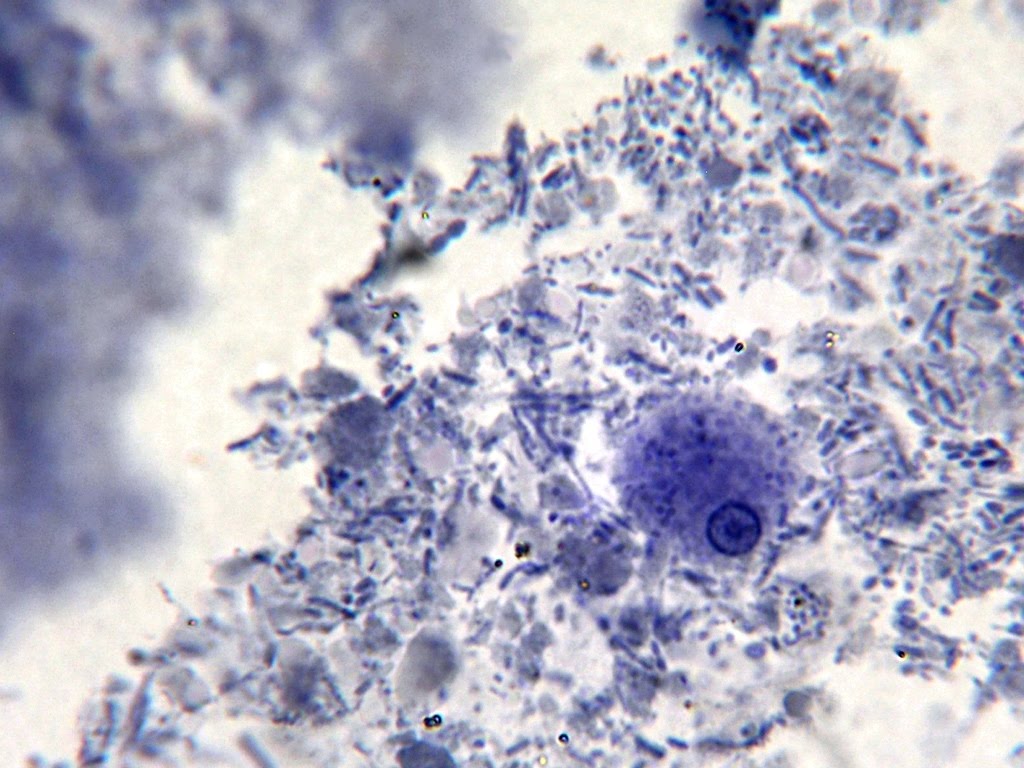 Fun With Microbiology (What's Buggin' You?): Entamoeba histolytica/dispar