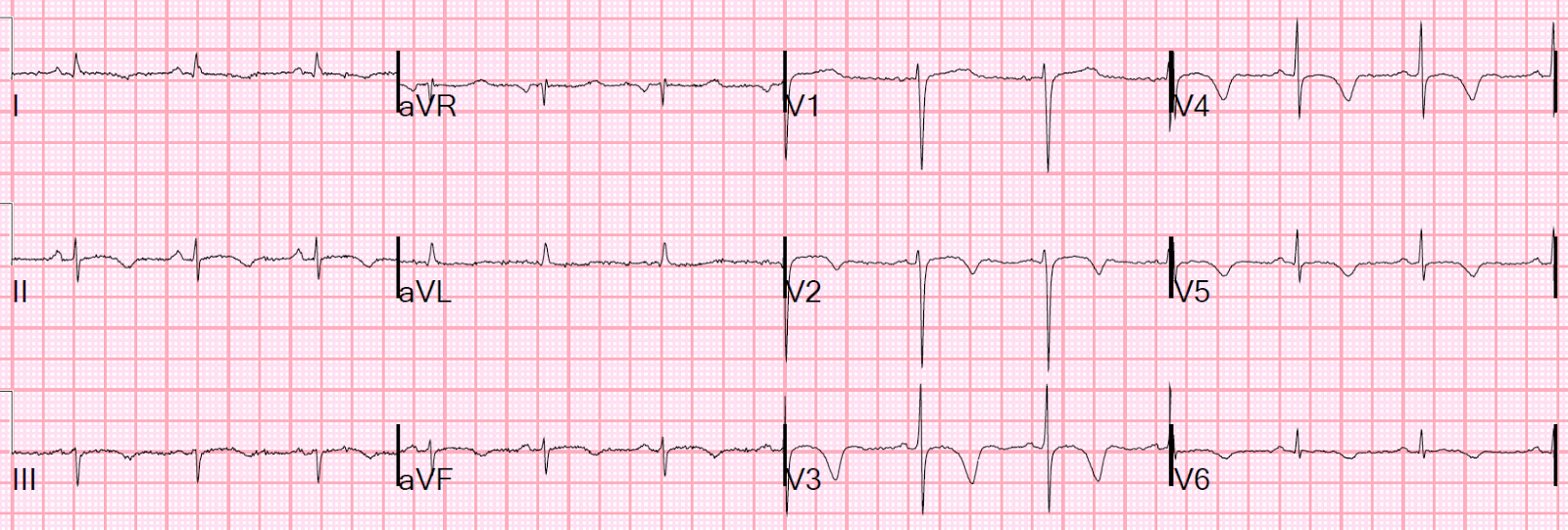 Dr. Smith's ECG Blog: September 2015
