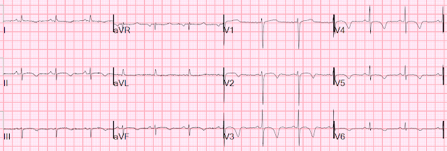 Dr. Smith's ECG Blog: September 2015