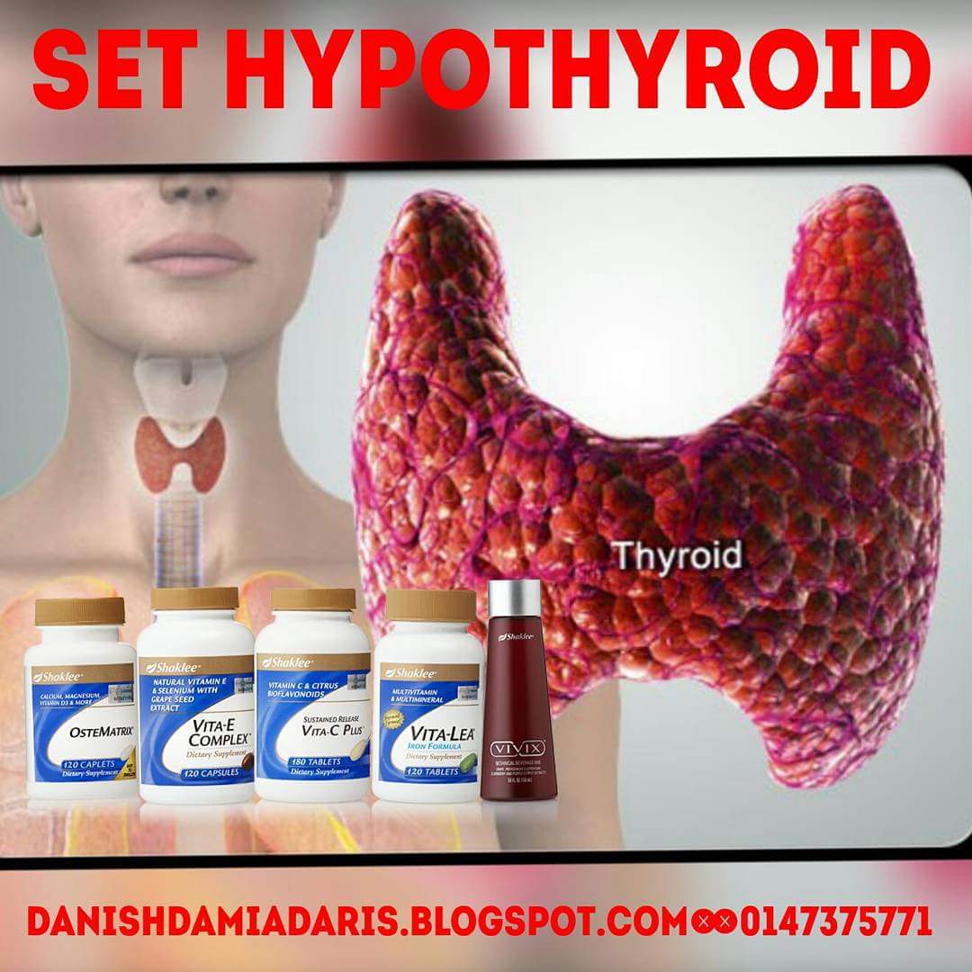 3D health beauty supplement: KENALI TIROID ; PUNCA, GEJALAN DAN CARA ...