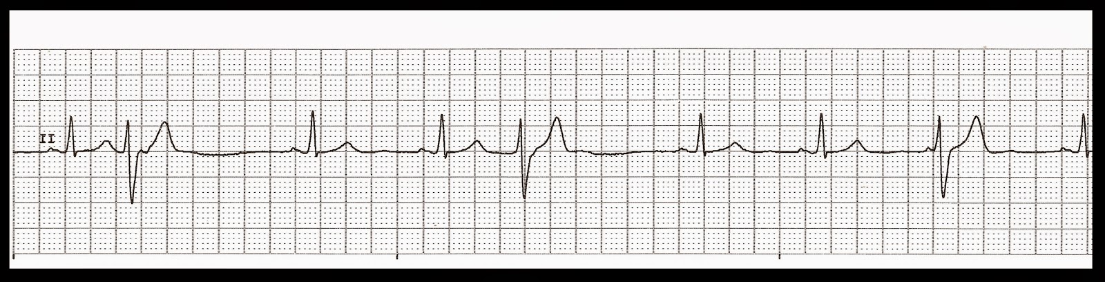 Practice EKG Strips 402