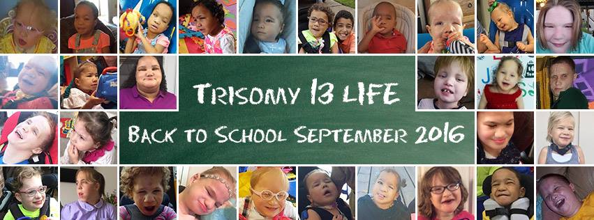 Trisomy 13 LIFE - Patau Syndrome: trisomy 13