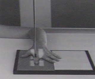 Radiología: MIEMBRO SUPERIOR